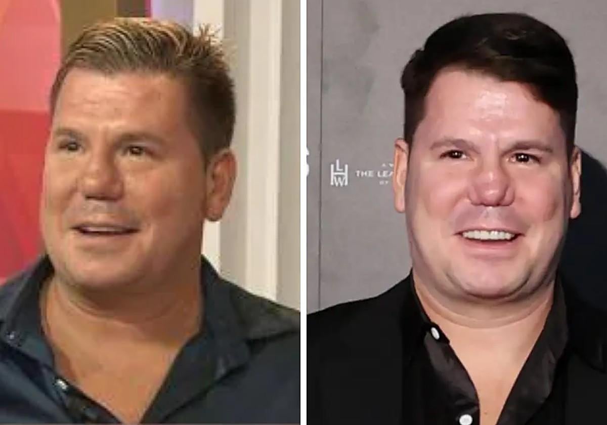 La nueva nariz de Lucas, de Andy y Lucas, sigue dando que hablar tras su operación estética | El ...